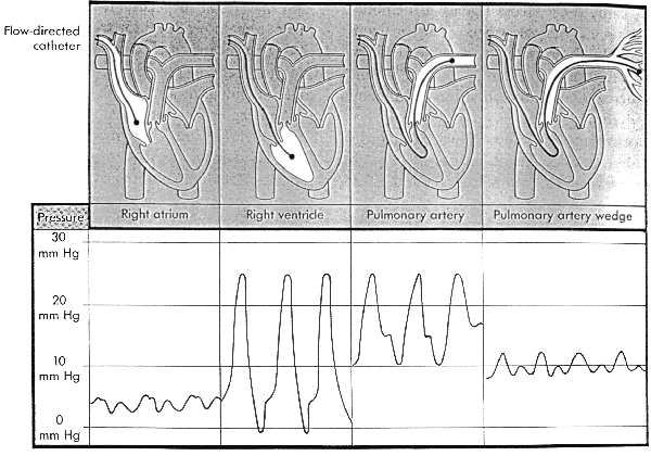 22/4 _hommes _femmes